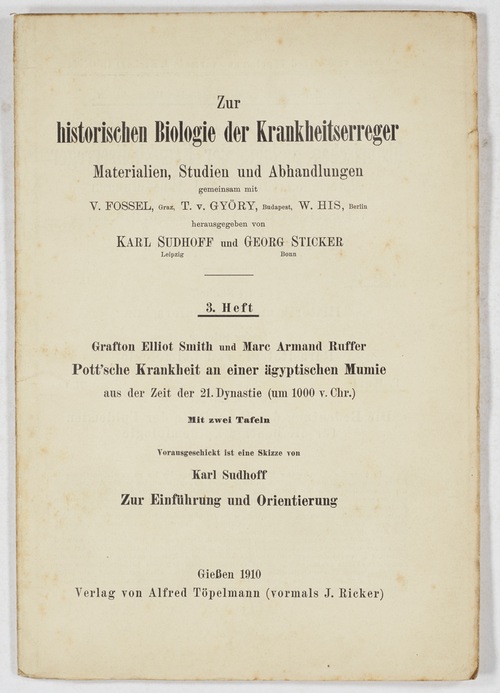 Pott'sche Krankheit an einer ägyptischen Mumie aus der Zeit der 21 ...