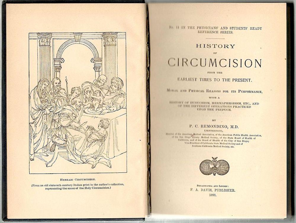 History of Circumcision; From the Earliest Times to the Present by ...