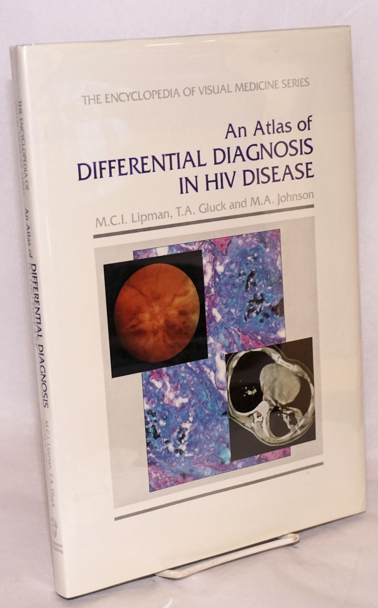 An atlas of differential diagnosis in HIV disease by Lipman, M.C.I., T ...