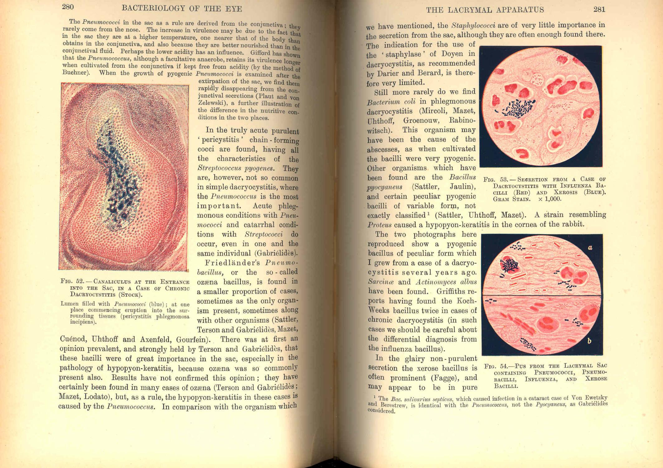 The Bacteriology of the Eye; w/87 Illus.,Some of Which are Coloured ...