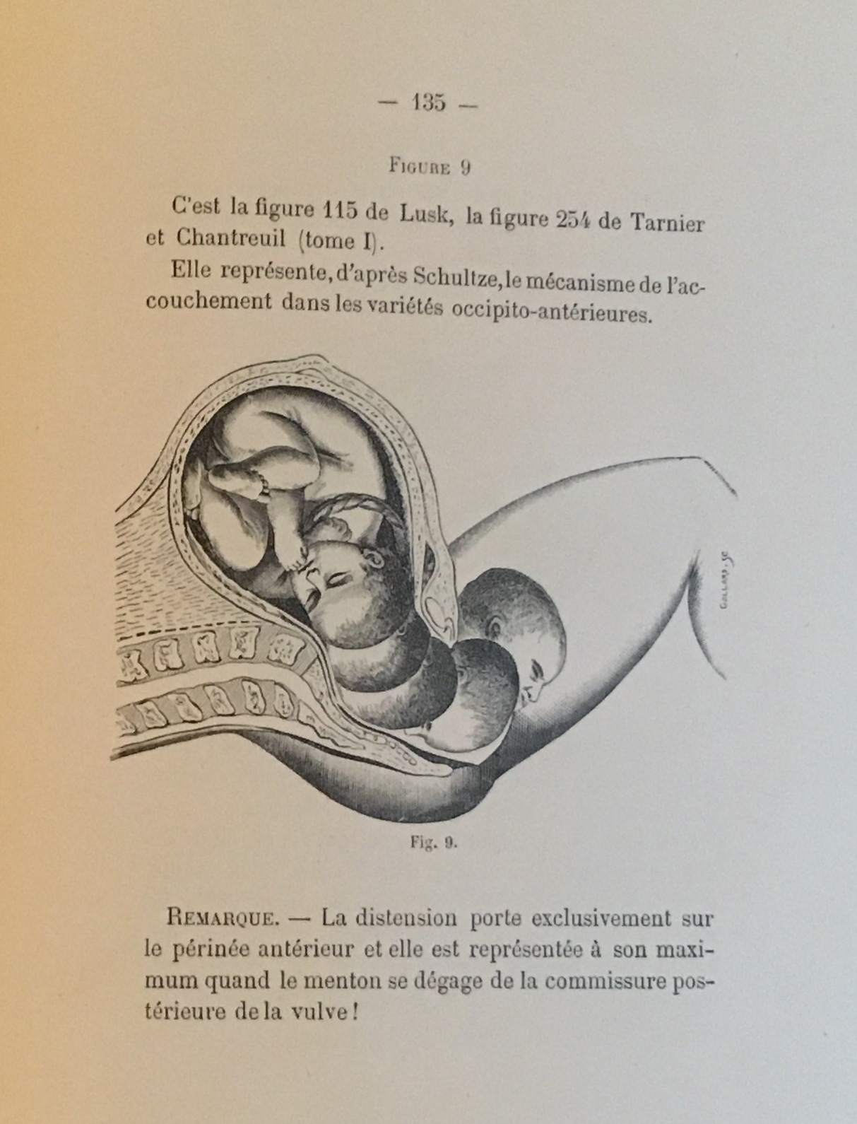 Du détroit inférieur musculaire du bassin obstétrical by Henri Varnier ...