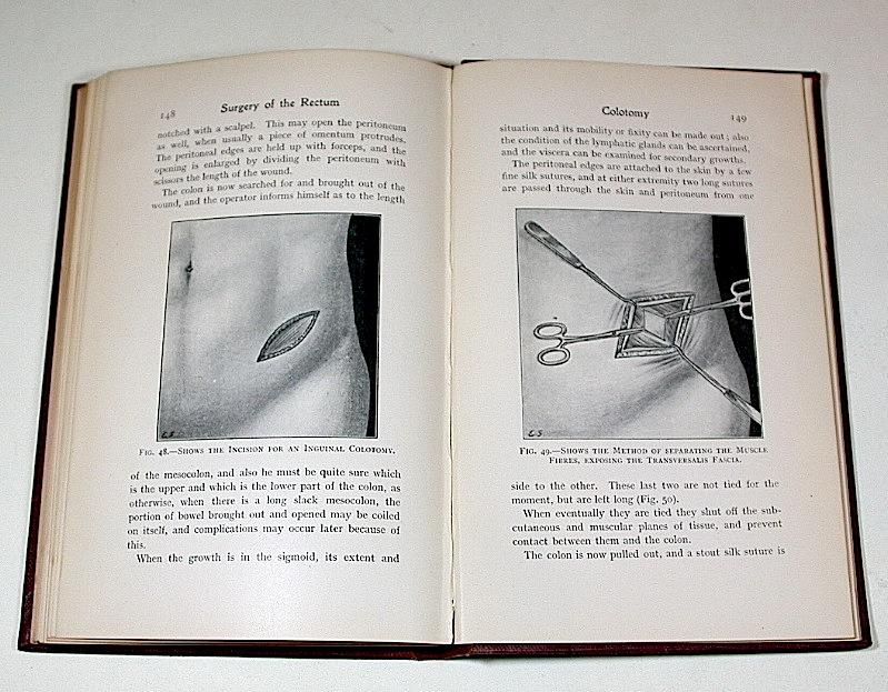 Surgery of the Rectum. by Wallis, Fred. C.: . Hardcover (1907 ...