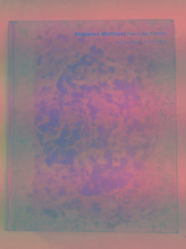 Diabetes Mellitus: theory and practice by ELLENBERG, Max & RIFKIN ...