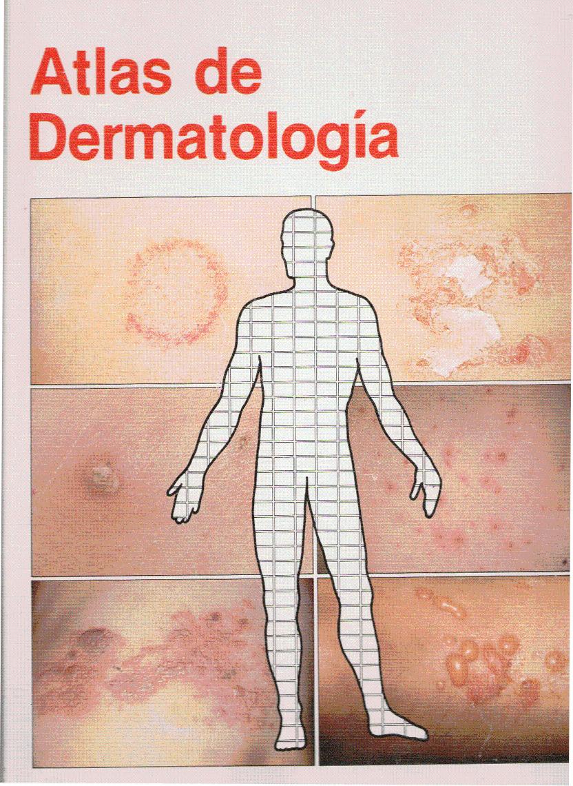 Atlas de Dermatología by Dr. D. Joaquín Soto Melo, Dr. D. Eduardo ...