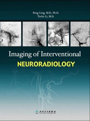 Imaging of Interventional Neuroradiology(Chinese Edition) de Ling Feng ...