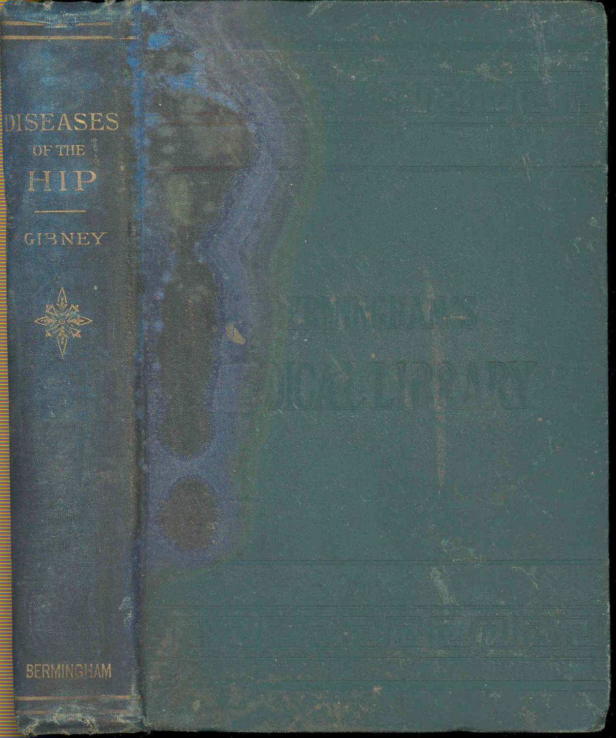 The Hip and its diseases. [The anatomy of the hip; Sprains & contusions ...