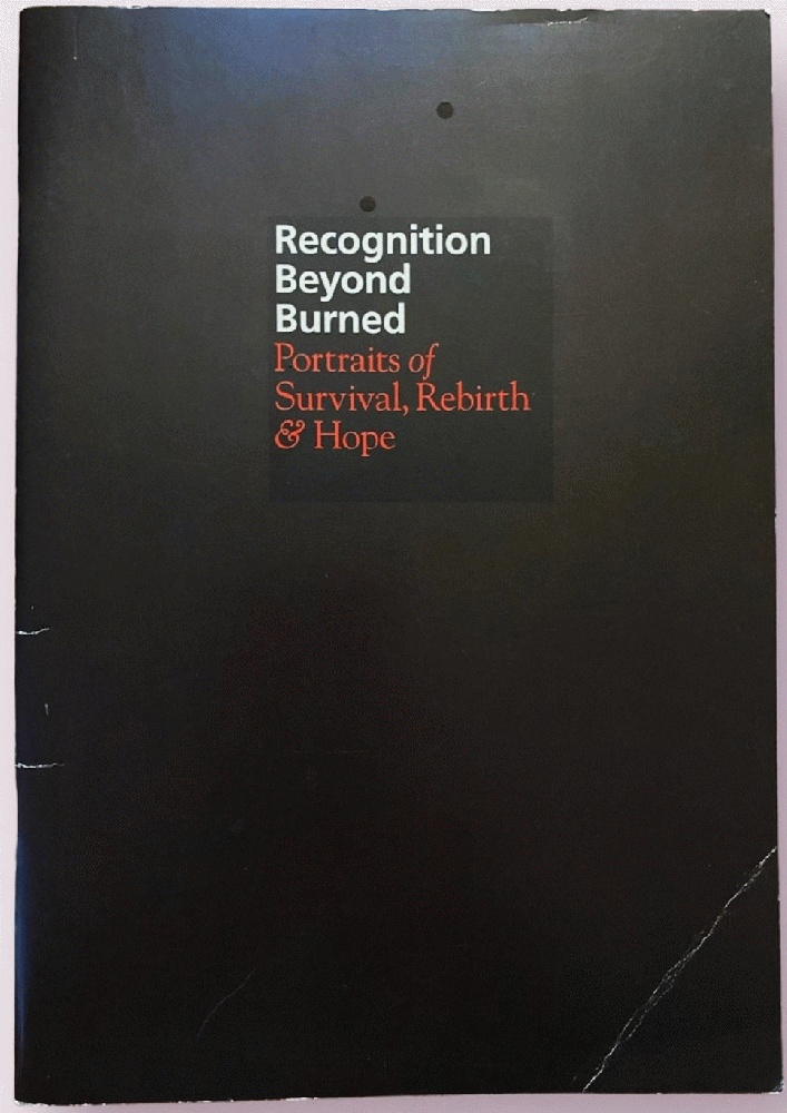 Recognition Beyond Burned: Portraits of Survival, Rebirth & Hope by ...
