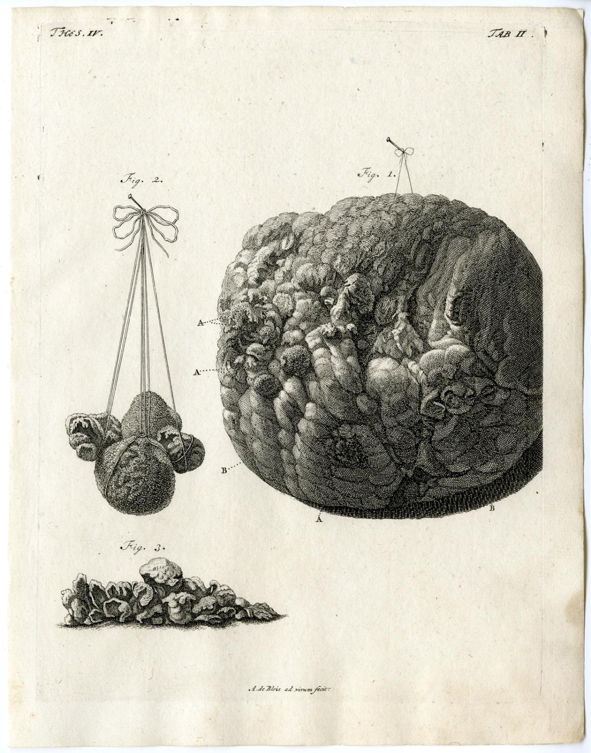 Antique Print-ANATOMY-BLADDER-COW-SURFACE-STONE-TAB II-DE BLOIS after ...