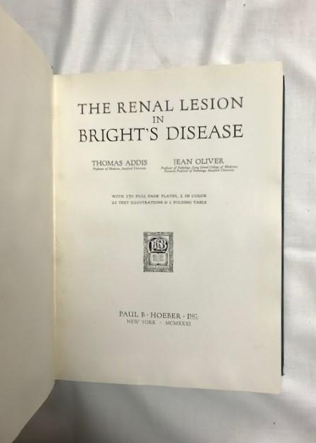 The Renal Lesion in Bright's Disease by ADDIS, Thomas & Oliver, Jean ...