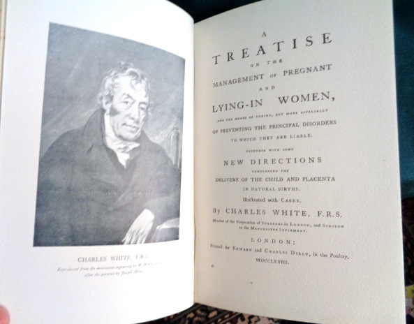 Charles White Of Manchester And The Arrest of Puerperal Fever. Being ...