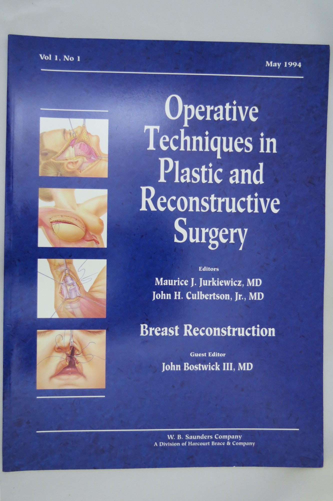 OPERATIVE TECHNIQUES IN PLASTIC AND RECONSTRUCTIVE SURGERY, VOL 1, NO 1 ... OPERATIVE TECHNIQUES IN PLASTIC AND RECONSTRUCTIVE SURGERY, VOL 1, NO 1 ...