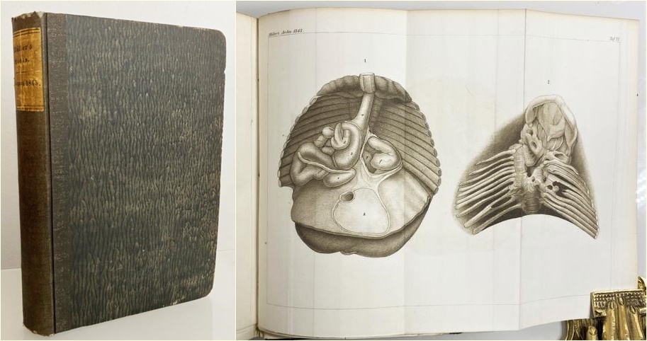 Ueber die Schädelformen der Nordbewohner. 46 S. In: Archiv fur Anatomie ...