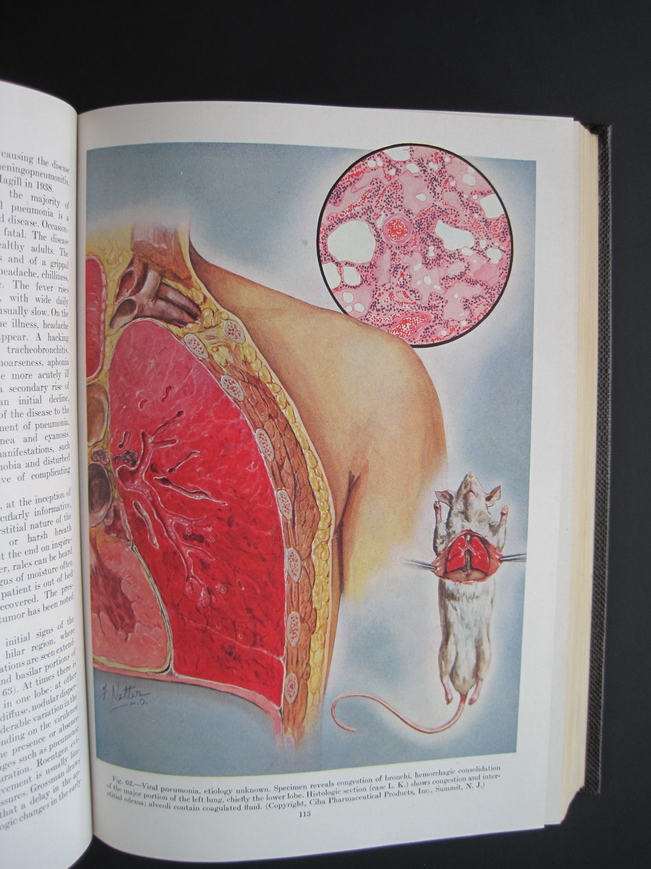 Diseases Of The Chest With Emphasis On X Ray Diagnosis By Rubin Eli H And Morris Rubin Fine