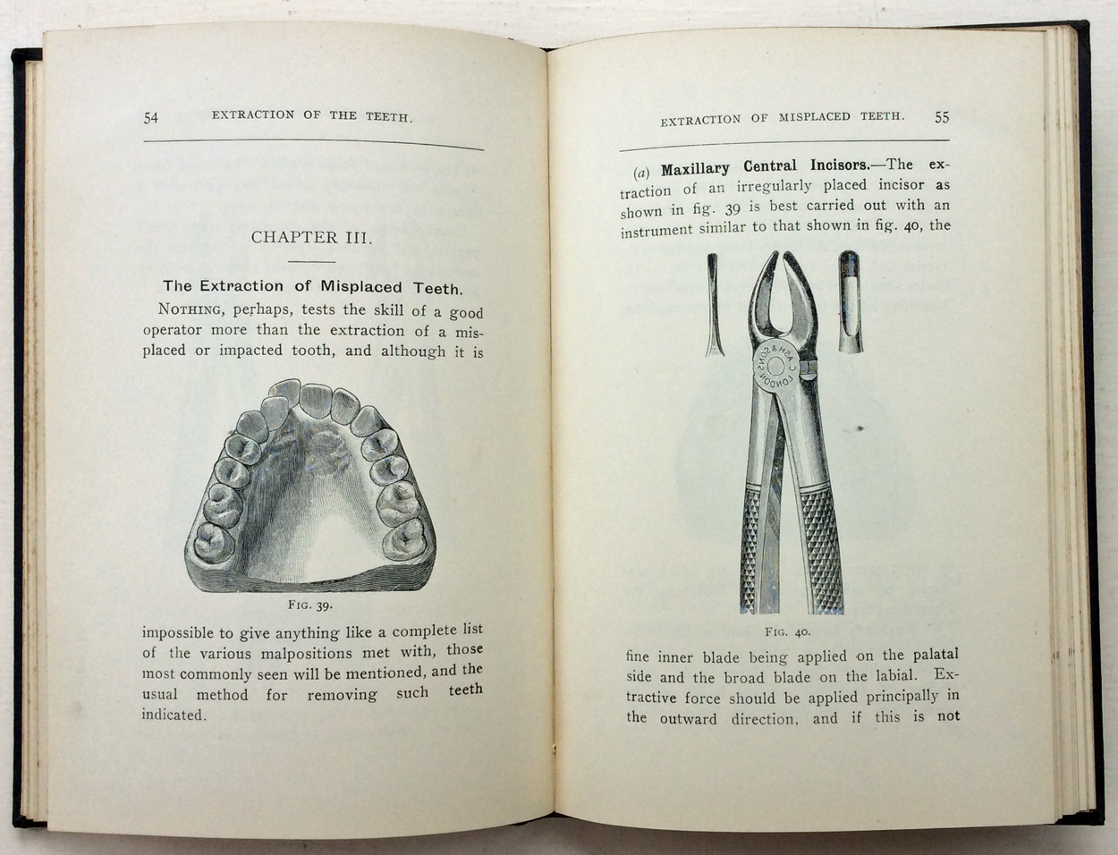 EXTRACTION OF THE TEETH. de COLYER, J F.[ Sir James Frank Colyer KBE ...