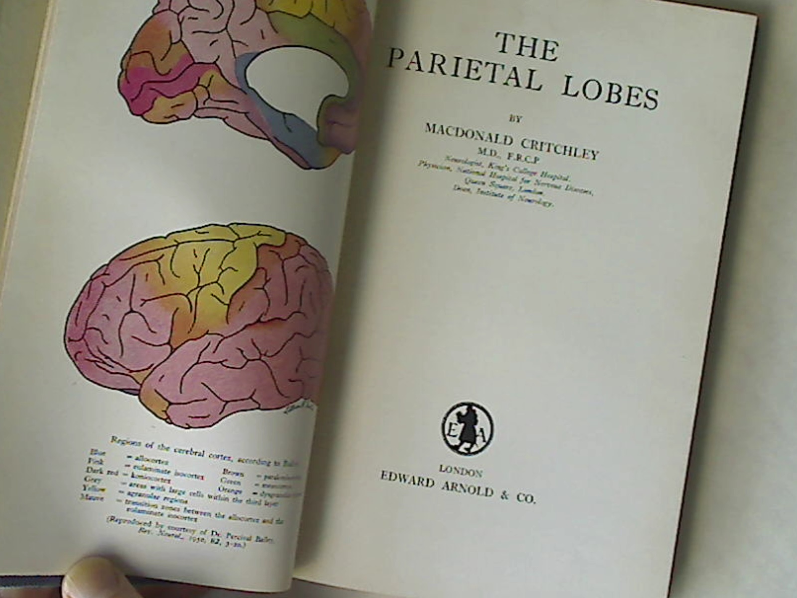 The Parietal Lobes. by Critchley, Macdonald:: Very Good Hardcover (1953 ...