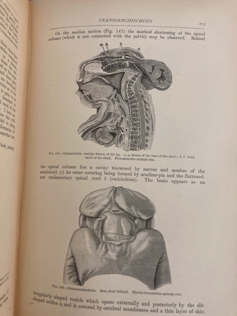 Text-Book of General Pathology and Pathological Anatomy. Volume 1. With ...