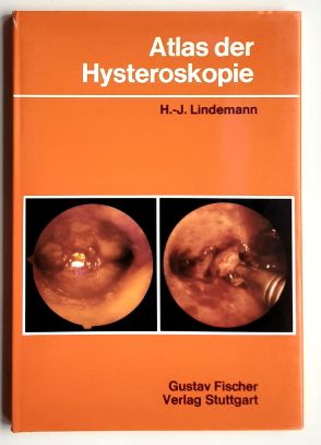 Hans-Joachim Lindemann : Atlas der Hysteroskopie. - ( 1. Auflage 1980 ...