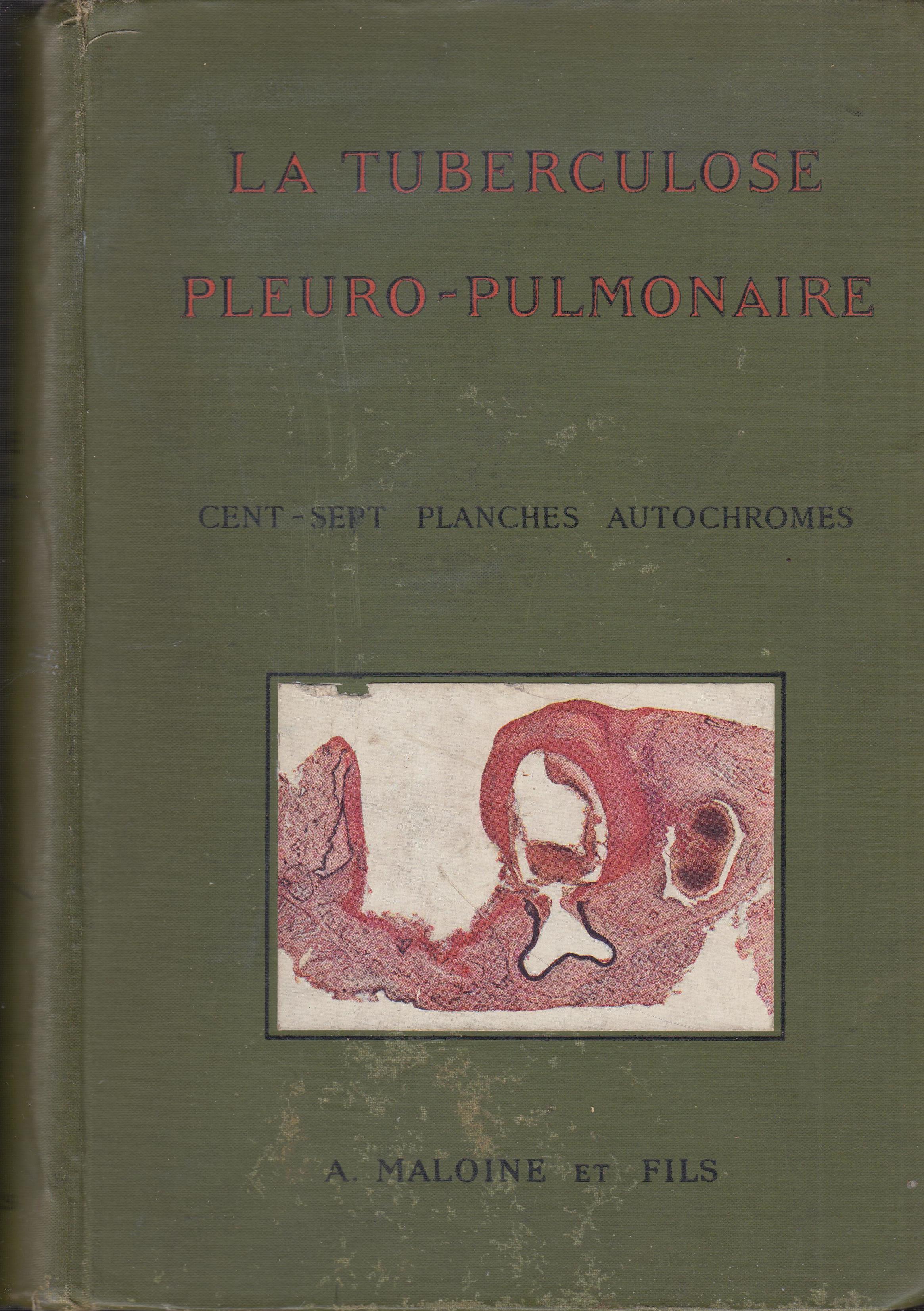 La tuberculose pleuro-pulmonaire . Maurice Letulle | Barnebys