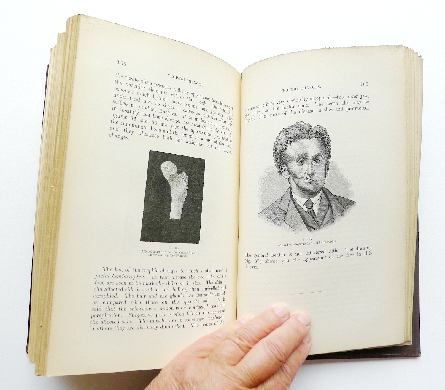 AN INTRODUCTION TO THE STUDY OF THE DISEASES OF THE NERVOUS SYSTEM ...