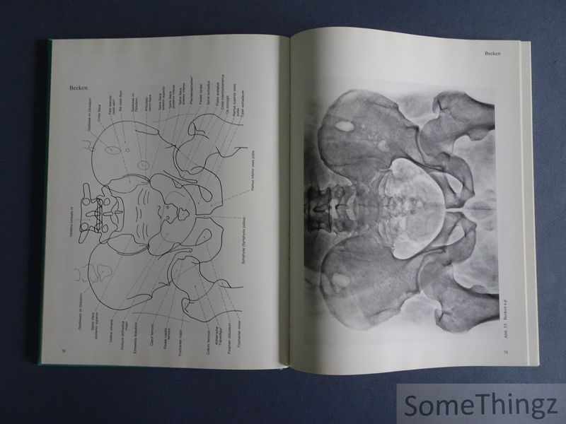 Atlas der Röntgenanatomie. de Lothar Wicke. | SomeThingz. Books etcetera.