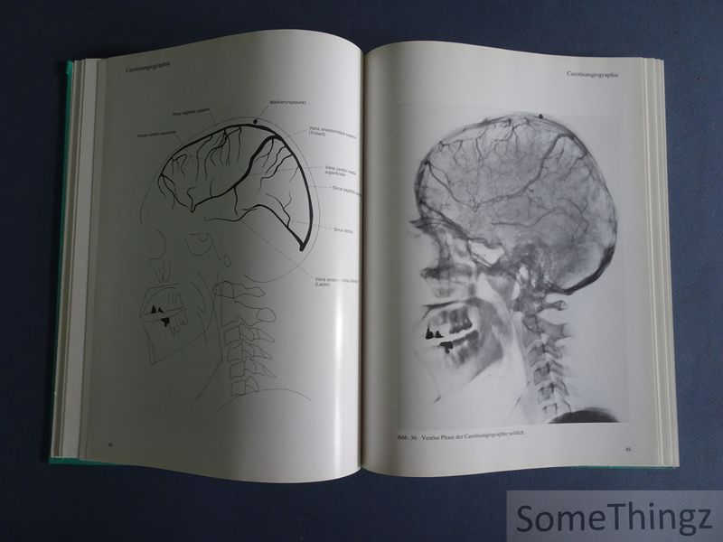 Atlas der Röntgenanatomie. de Lothar Wicke. | SomeThingz. Books etcetera.