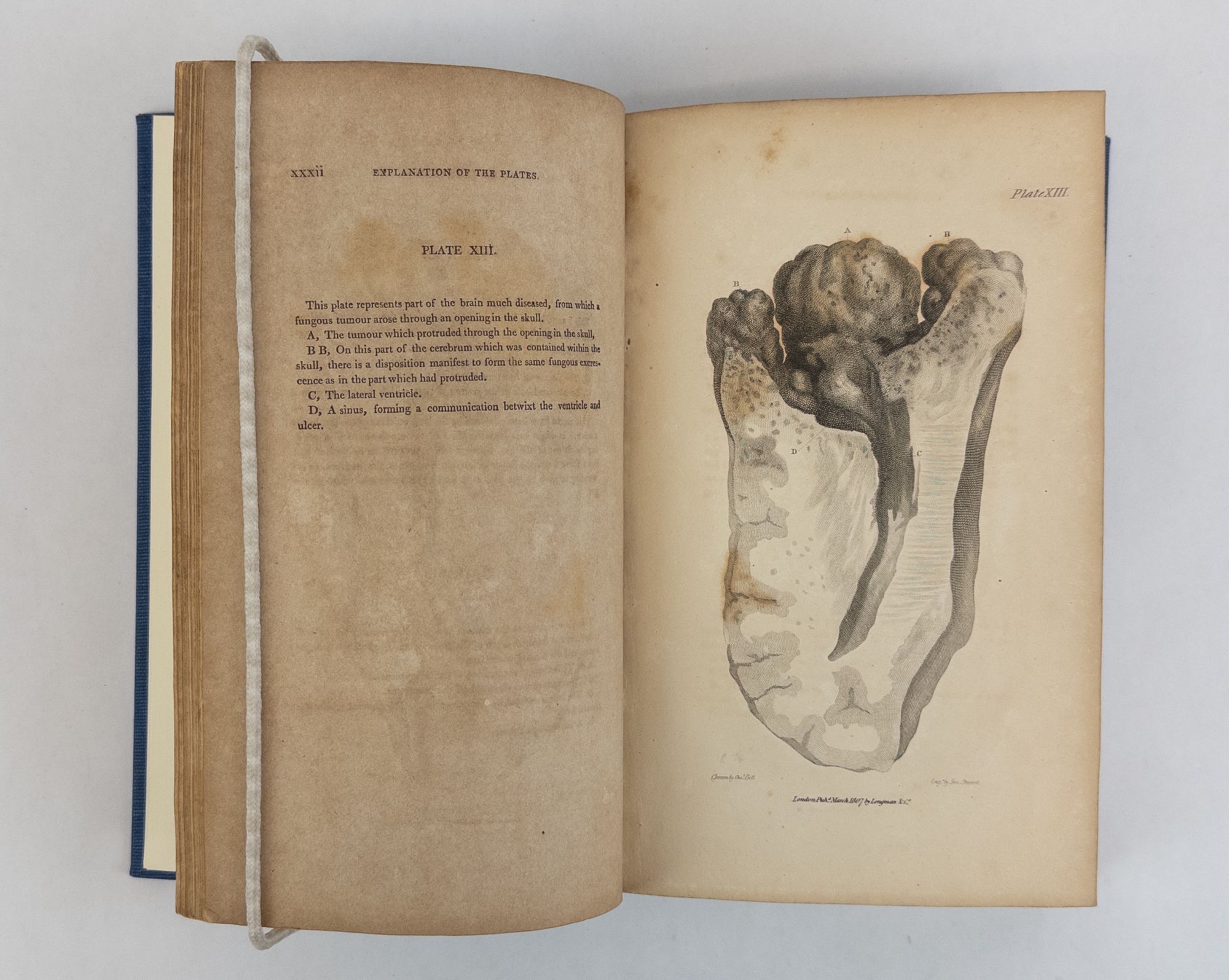 A SYSTEM OF OPERATIVE SURGERY, FOUNDED ON THE BASIS OF ANATOMY [2 ...