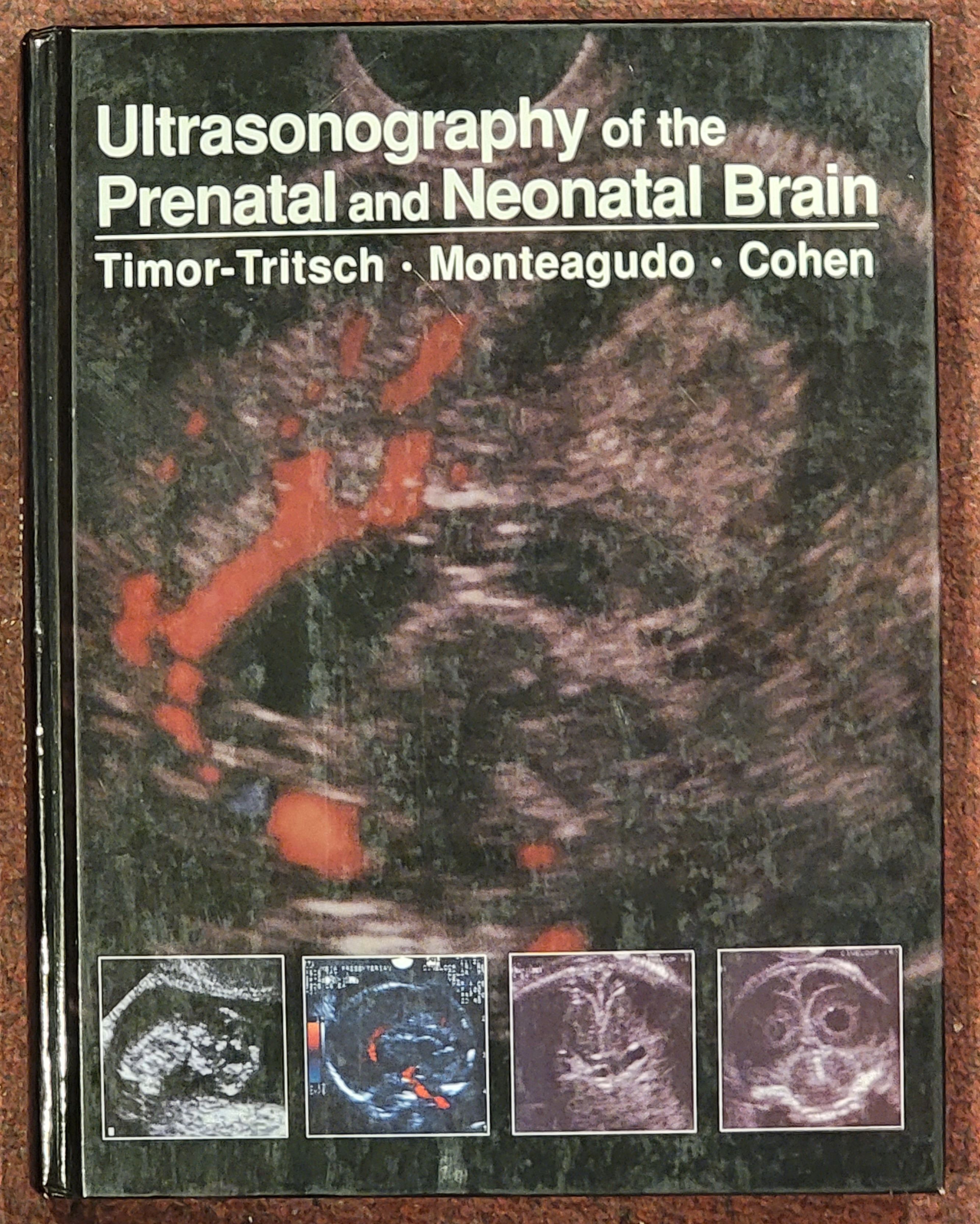 Ultrasonography of the Prenatal and Neonatal Brain by Ana Monteagudo ...