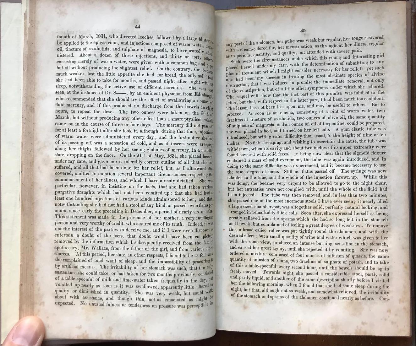 NEW VIEWS OF THE PROCESS OF DEFECATION. AND THEIR APPLICATION TO THE ...