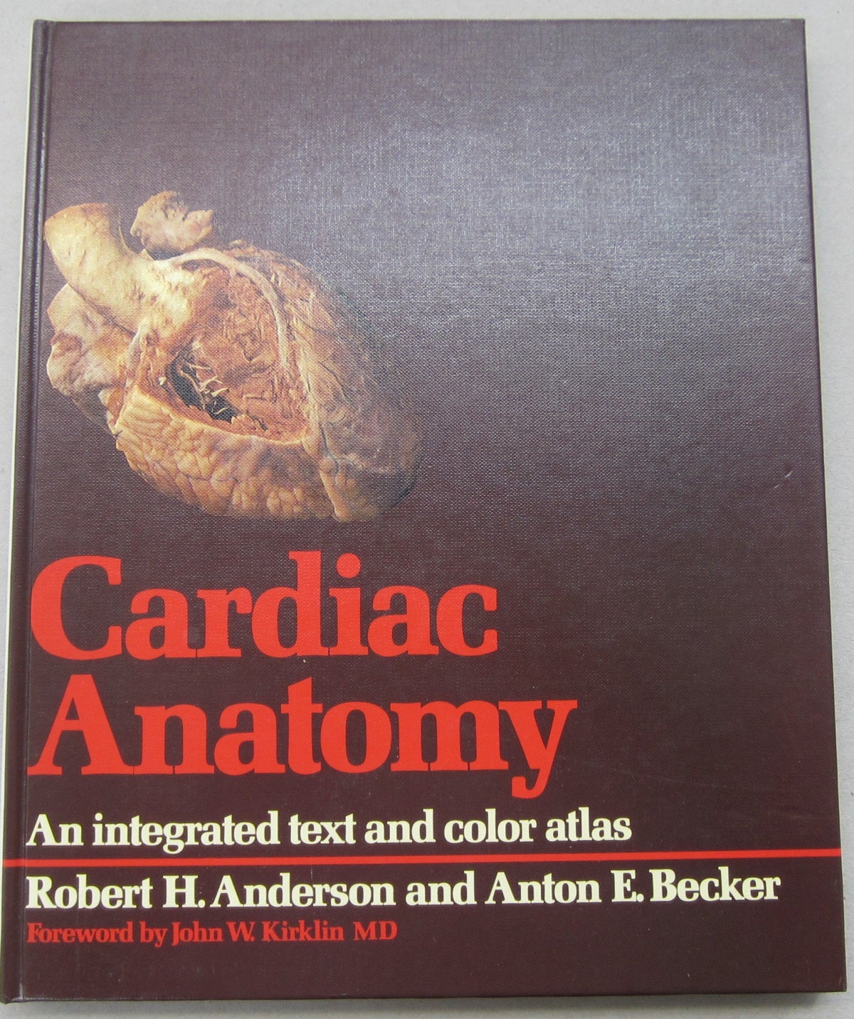 Cardiac anatomy: An integrated text and colour atlas by Anderson ...