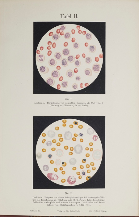 Klinische Pathologie des Blutes. by Grawitz, Ernst: (1896) | Antiq. F ...