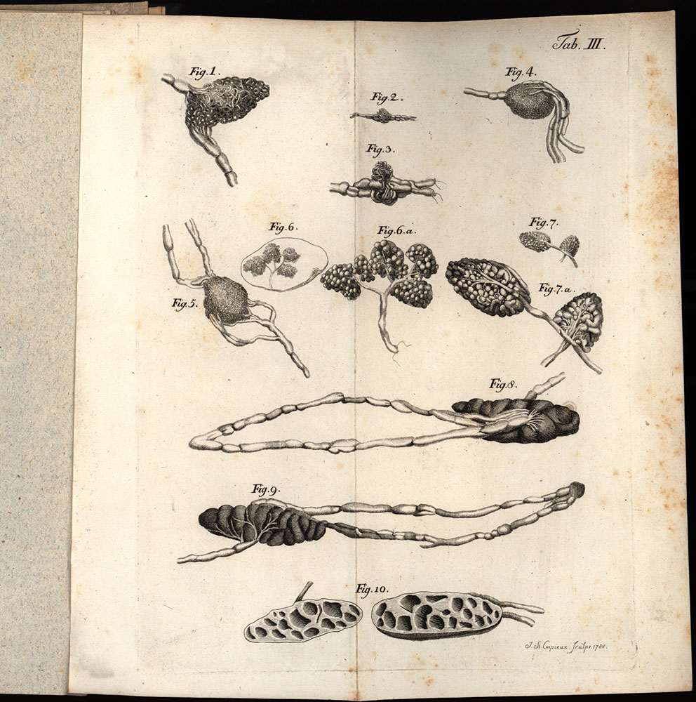 Geschichte und Beschreibung der einsaugenden Gefäße oder Saugadern des ...