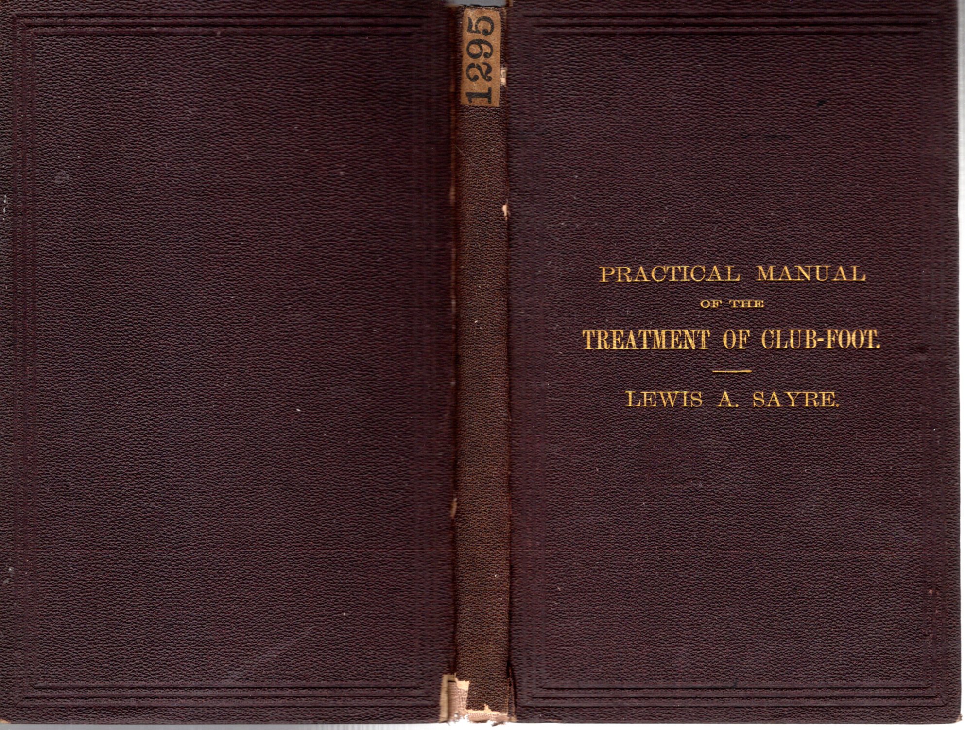 A Practical Manual of the Treatment of Club-Foot [Insc By Author] de ...