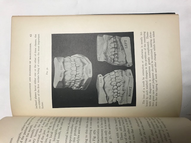 Treatment of Malocclusion of the Teeth and Fractures of the Maxillae ...