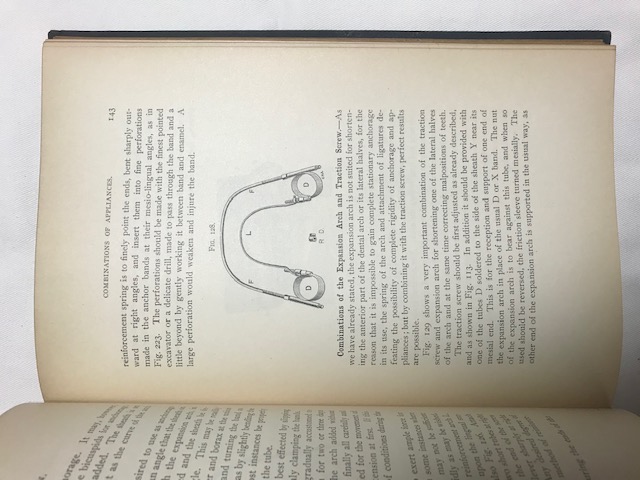 Treatment of Malocclusion of the Teeth and Fractures of the Maxillae ...