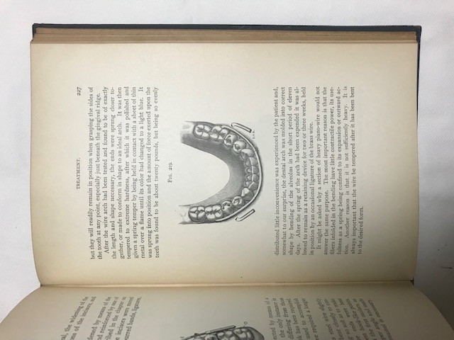 Treatment of Malocclusion of the Teeth and Fractures of the Maxillae ...