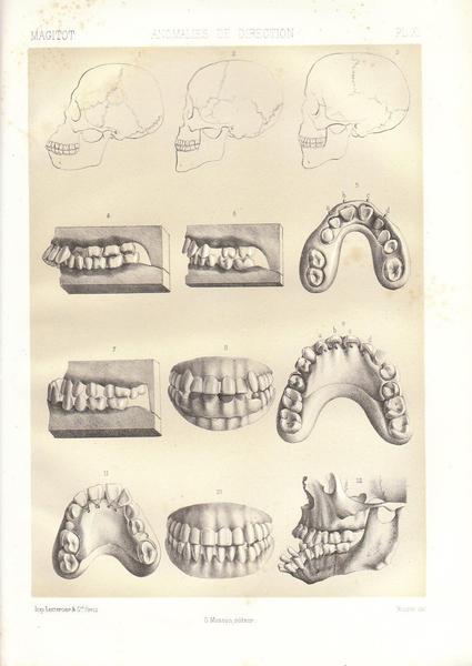 Traité des anomalies du système dentaire chez l'homme et les mammifères ...