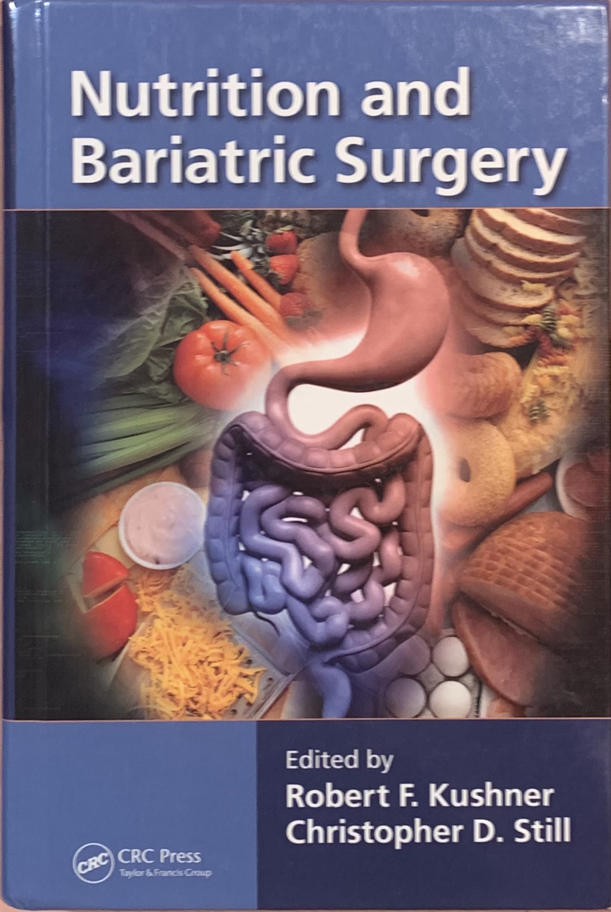 Nutrition and Bariatric Surgery: Very Good Hardcover (2014) 1st Edition ...