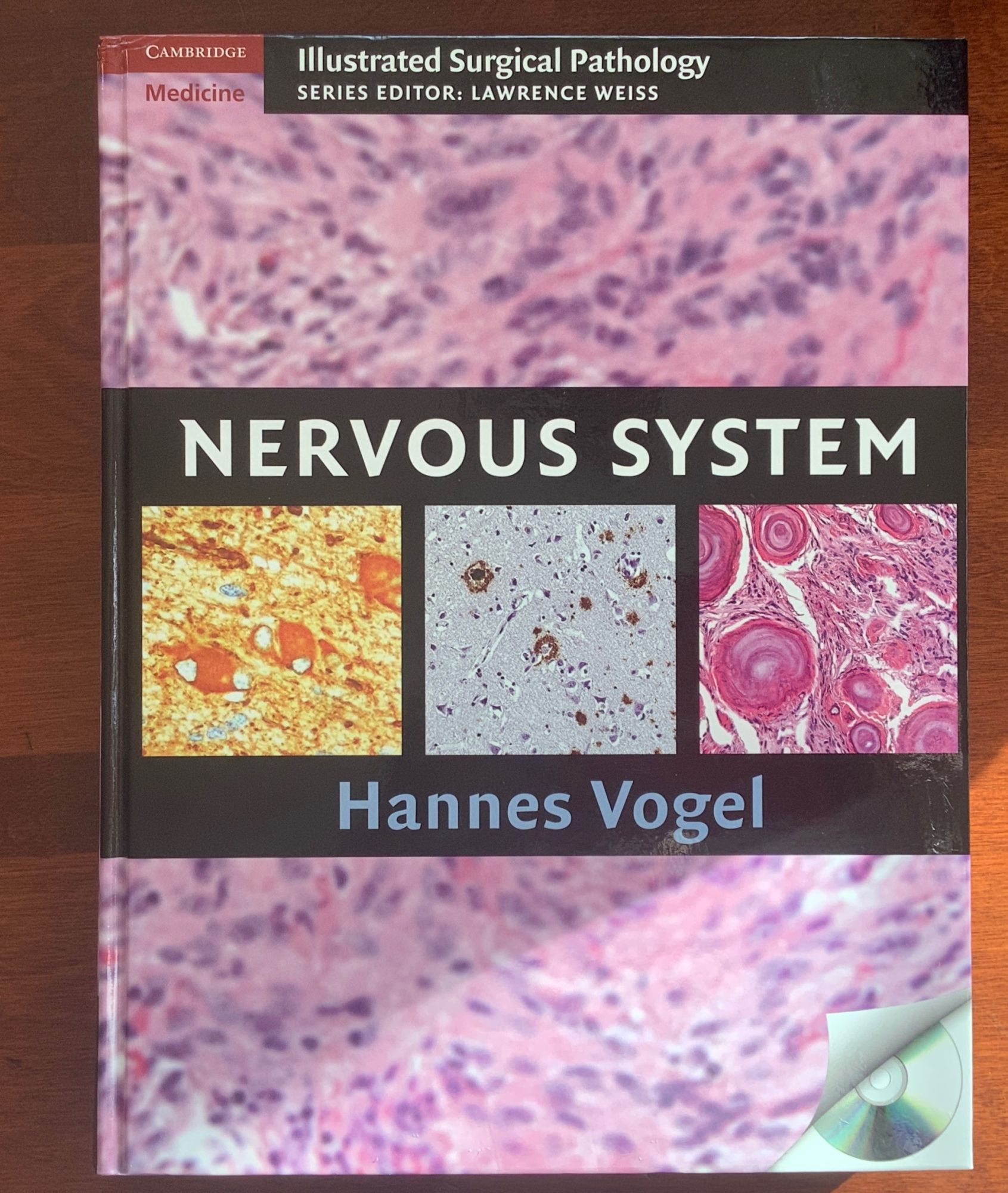 Nervous System: Cambridge Illustrated Surgical Pathology by Hannes ...