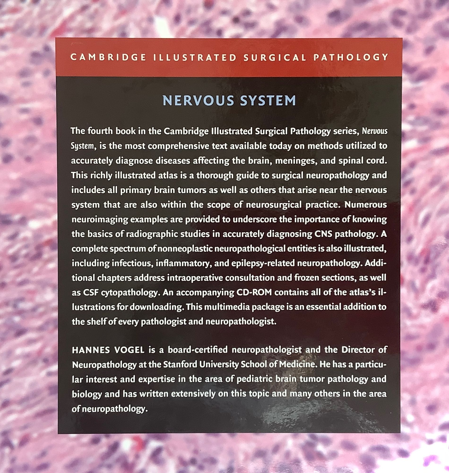 Nervous System: Cambridge Illustrated Surgical Pathology by Hannes ...