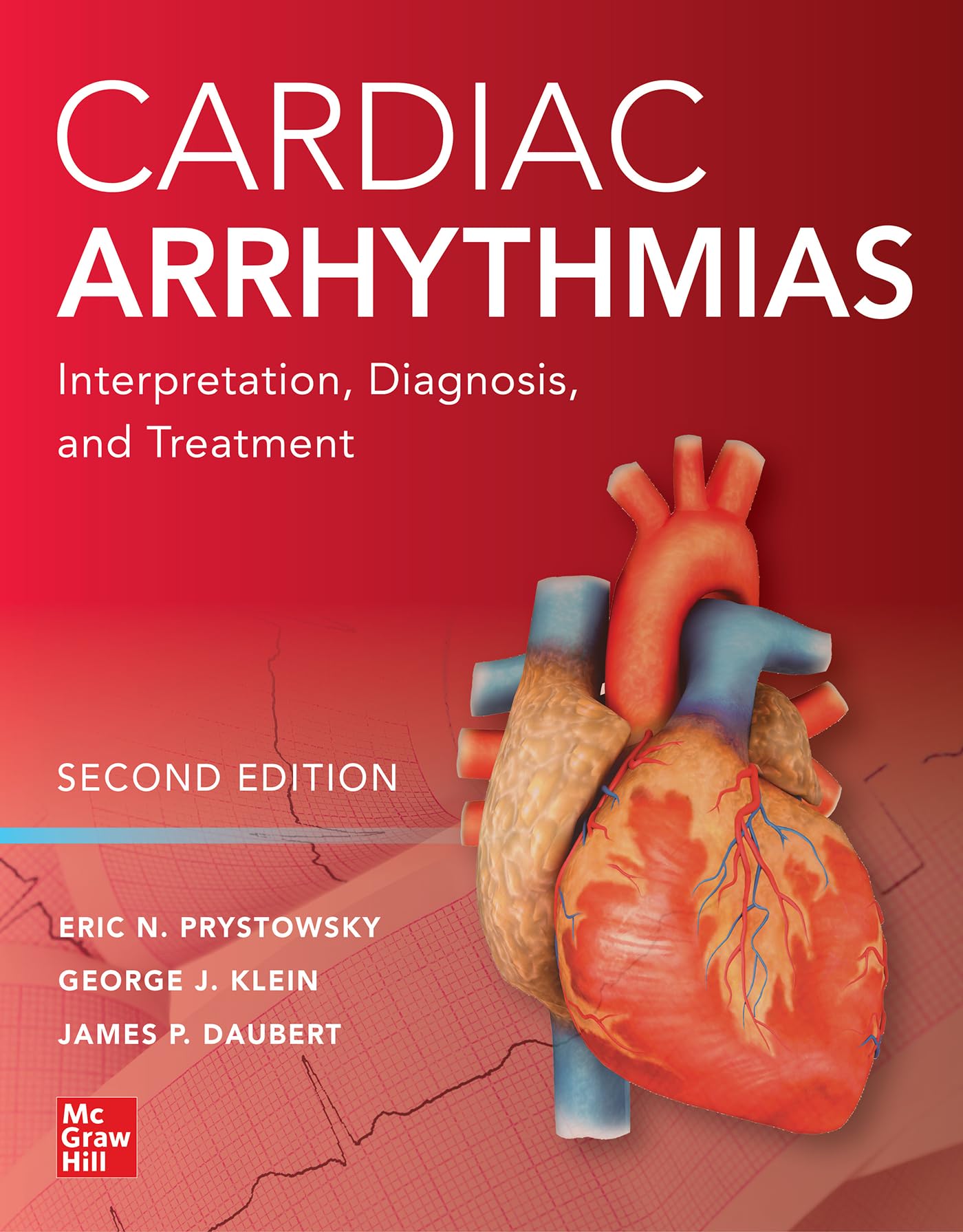Cardiac Arrhythmias: Interpretation, Diagnosis and Treatment, Second ...