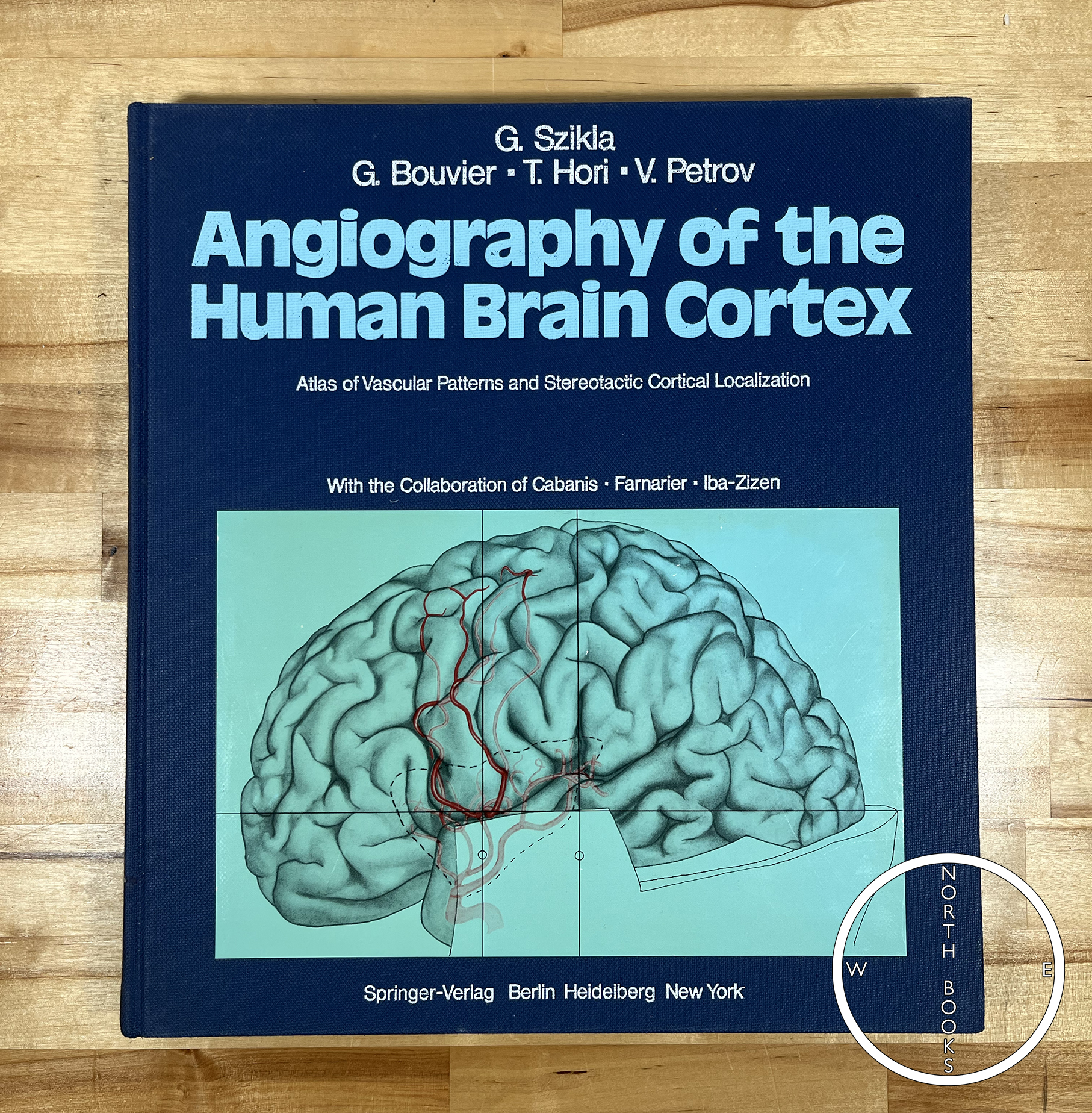 Angiography of the Human Brain Cortex: Atlas of Vascular Patterns and ...