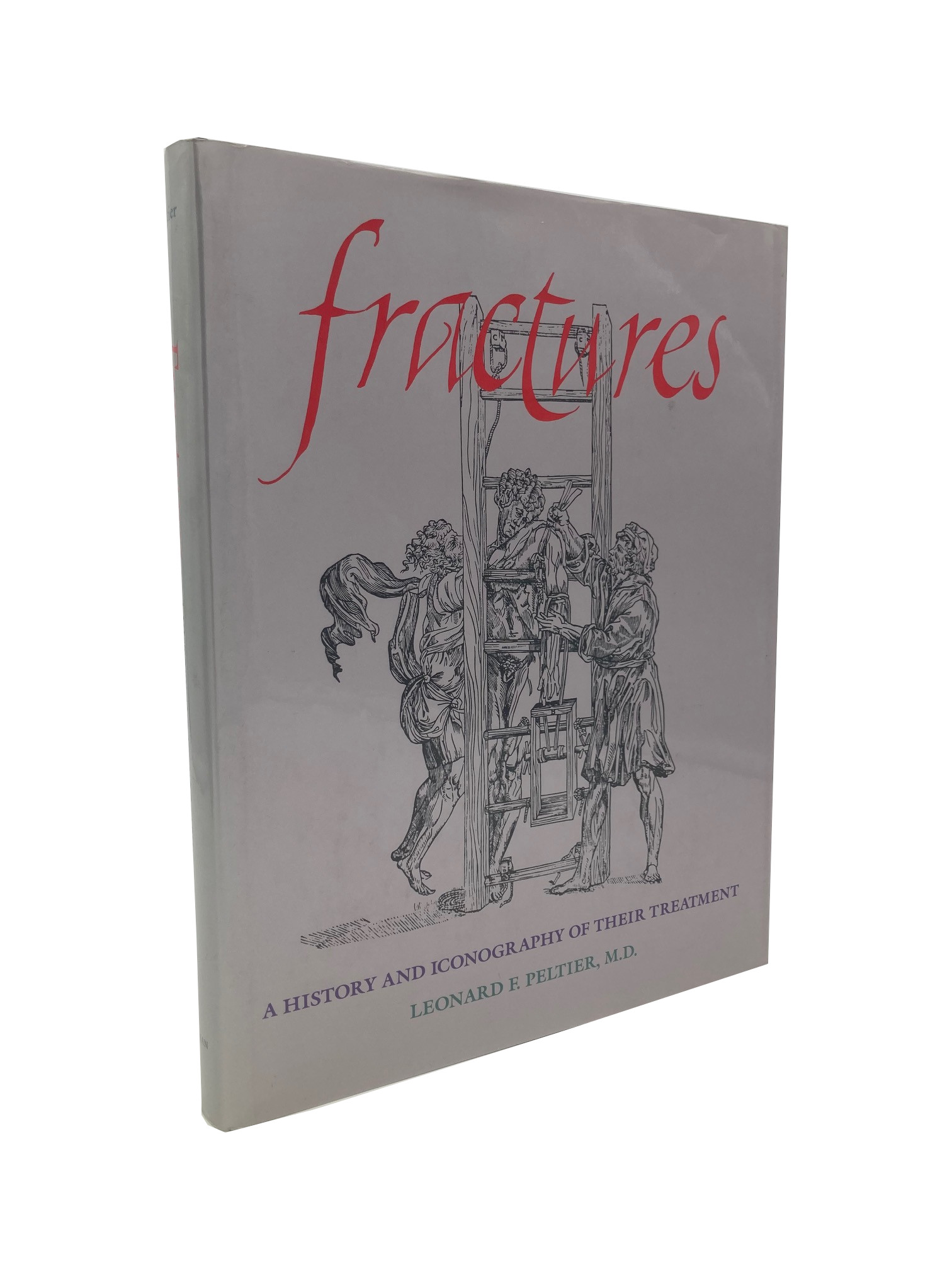 Fractures - A History and Iconography of Their Treatment by Peltier ...