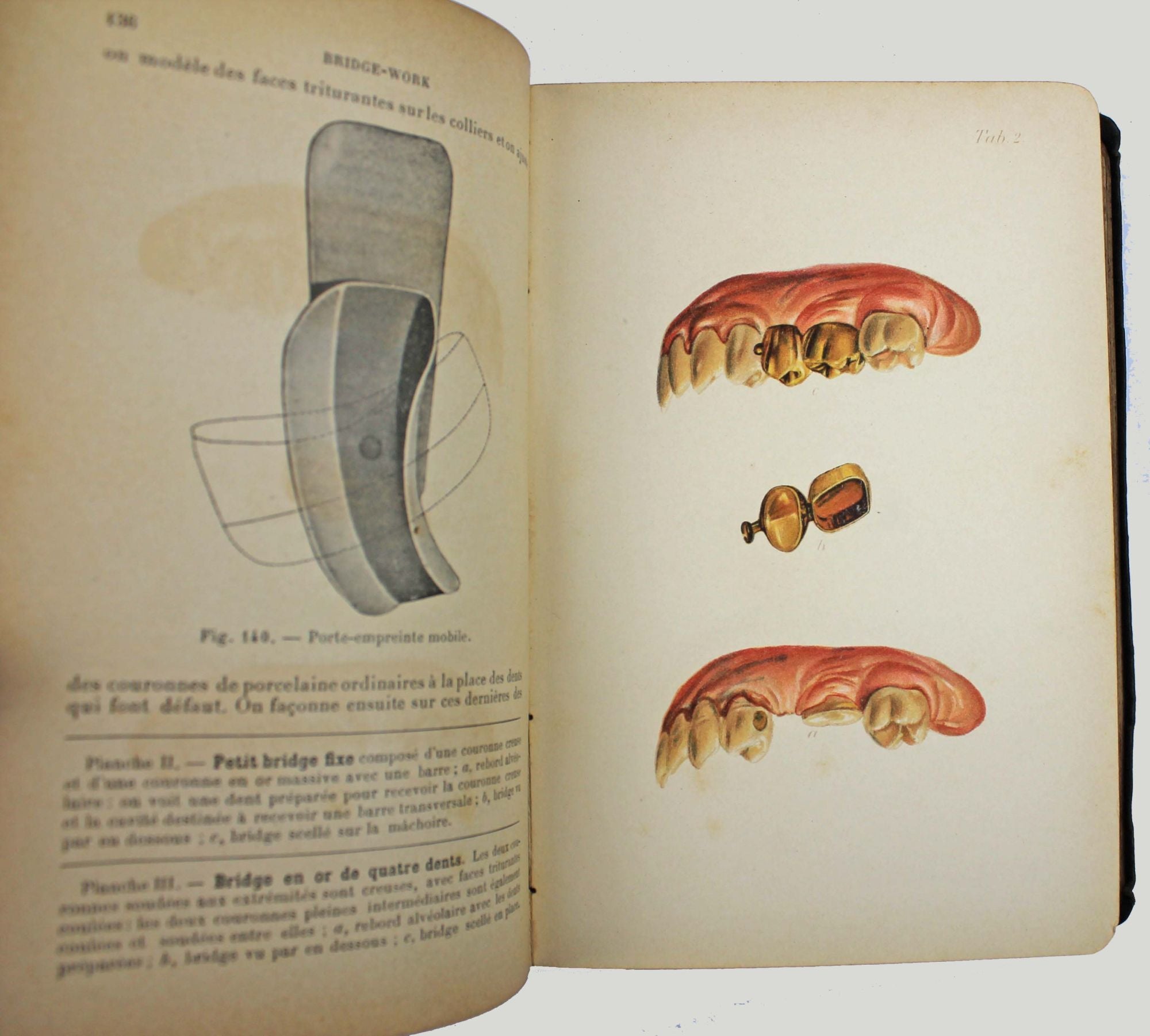 Atlas-manuel de prothèse dentaire et buccale. Edition française par le ...