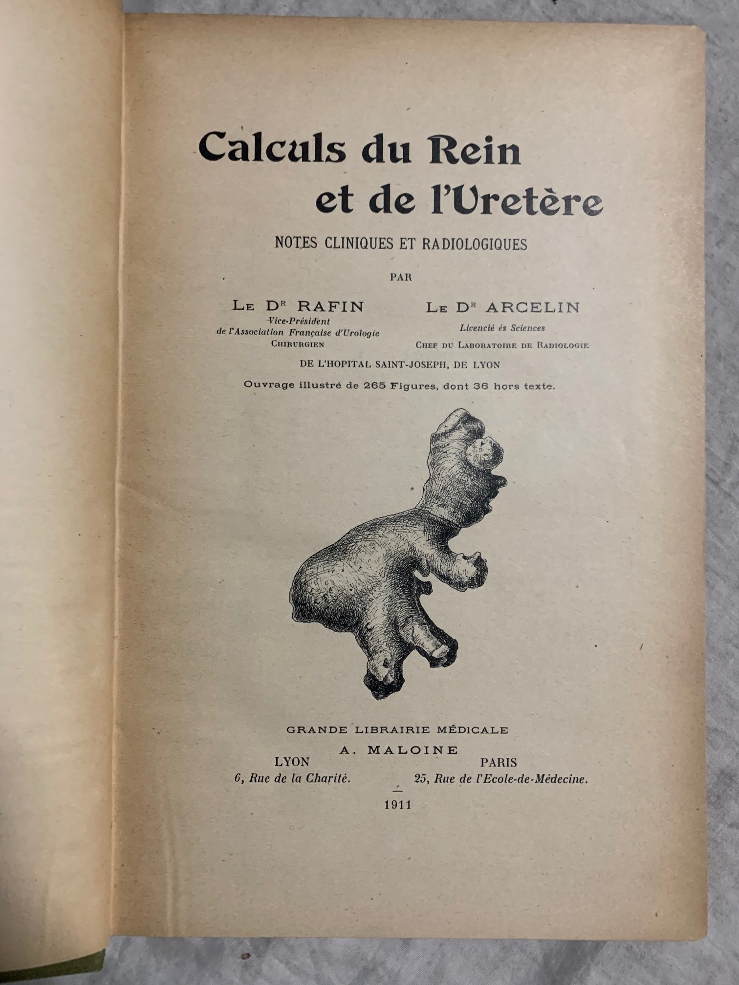CALCULS DU REIN ET DE L'URETERE by RAFIN - ARCELIN: (1911) | Librería ...