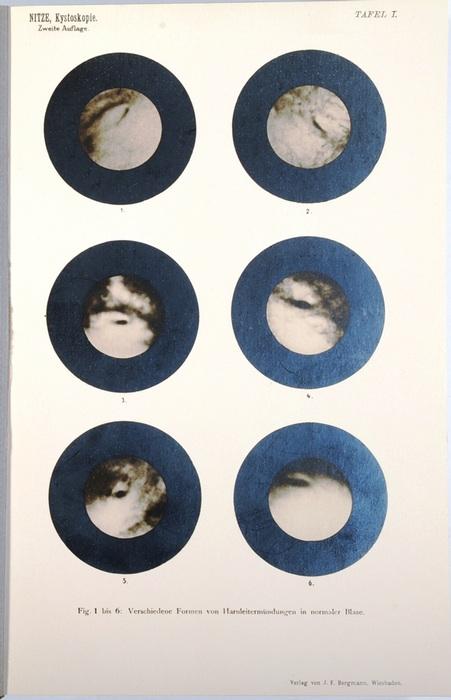 Lehrbuch der Kystoskopie, ihre Technik und klinische Bedeutung. Zweite ...