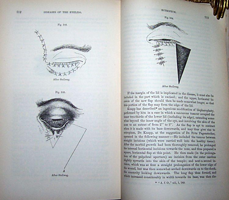 A Treatise on the Diseases of the Eye. Full Leather Binding. by WELLS ...