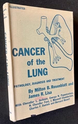 Cancer of the Lung: Pathology, Diagnosis and Treatment by Milton B ...