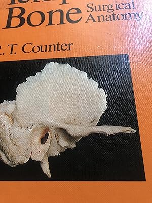 Color Atlas of Temporal Bone Surgical Anatomy. by Counter, R. T.: Good ...