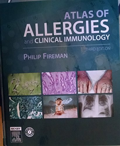 Atlas Of Allergies And Clinical Immunology Textbook With Cd Rom