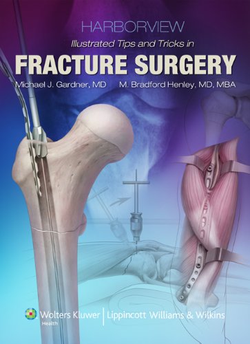 Harborview Illustrated Tips And Tricks In Fracture Surgery By Gardner